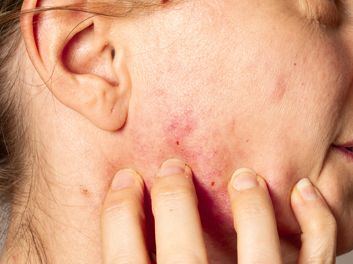 5 Home Remedies to Soothe Sensitive Skin – Oleum Cottage